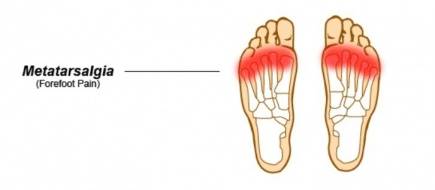 Foot Pain: 13 Common Foot Conditions & Treatment Tips | ReLiva ...