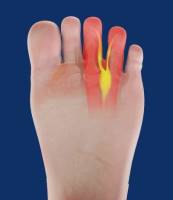 Foot Pain: 13 Common Foot Conditions & Treatment Tips | ReLiva ...