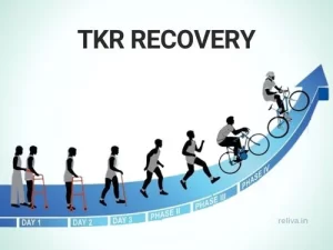 Knee Replacement Surgery: Care | ReLiva Physiotherapy